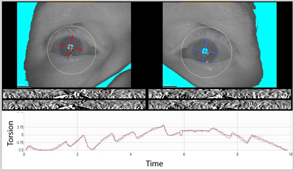EyeLink 3 - Eye and Head Tracker - Fast, Accurate, Reliable Eye Tracking