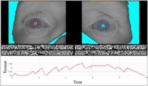 EyeLink 3 - Eye and Head Tracker - Fast, Accurate, Reliable Eye Tracking