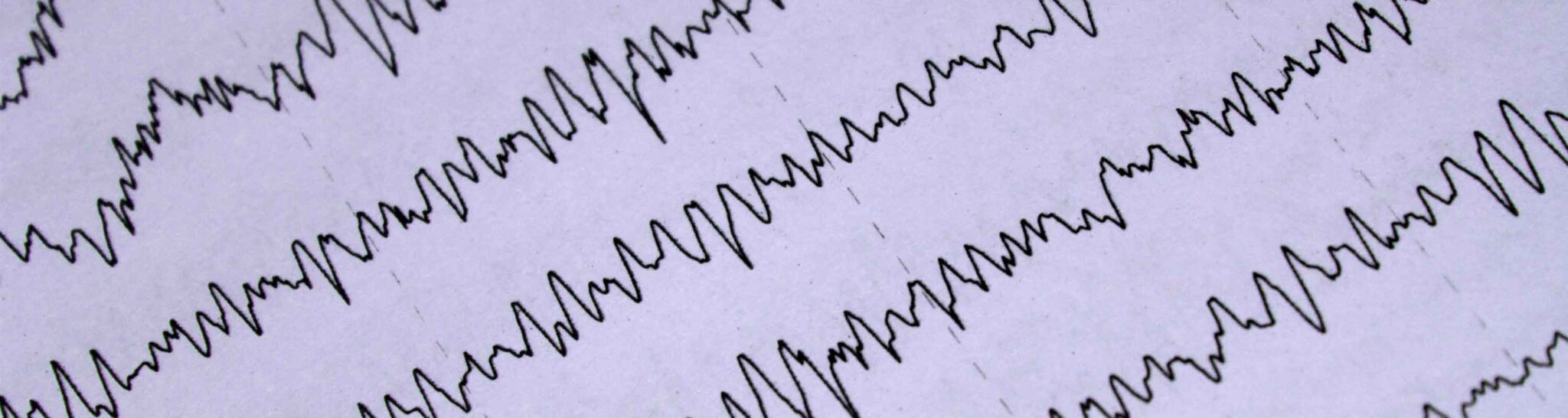 EEG, Eye-Tracking, and Working Memory - Fast, Accurate, Reliable Eye ...